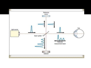 Optical Coherence Tomography (OCT) | PPTX