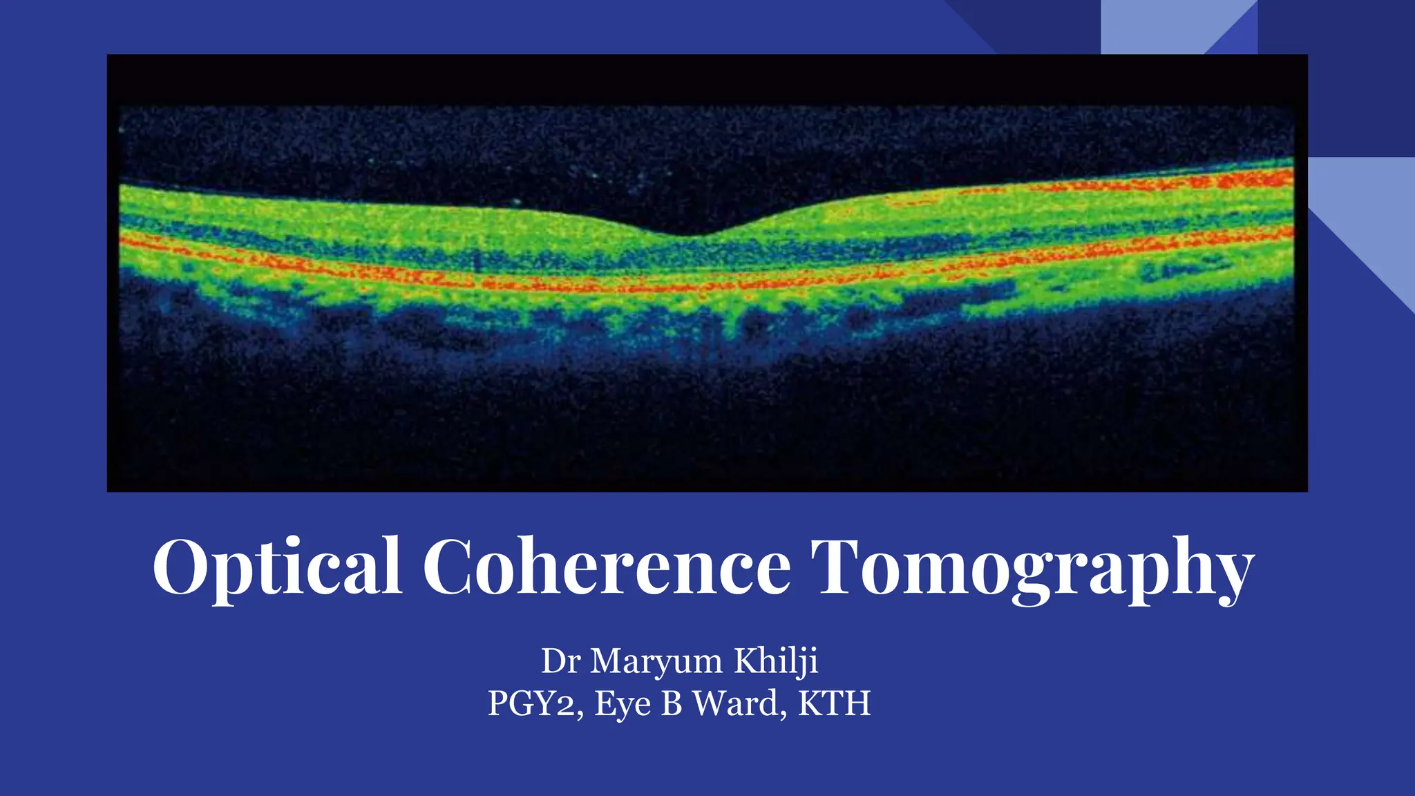 Optical coherence tomography in Ophthalmology.pptx