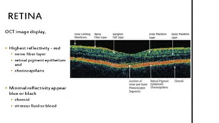 Ophthalmology findings ( OCT AND OTHER GRAPHS) | PPT