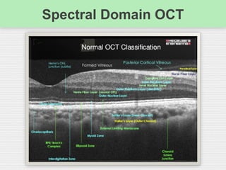 OCTA Optical Coherence Tomography angiography | PPS
