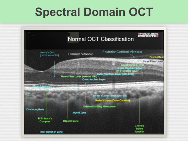 OCTA Optical Coherence Tomography angiography | PPS