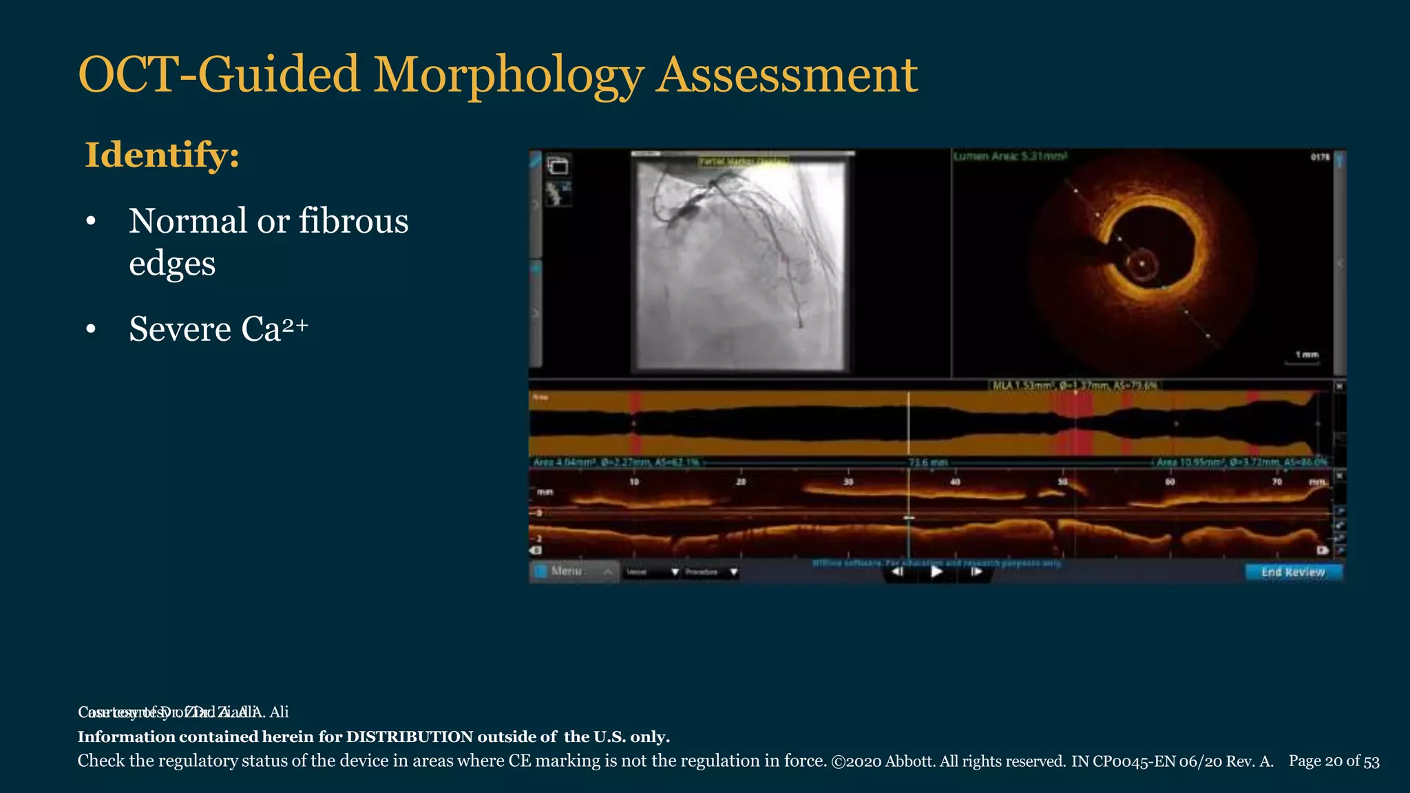 OCT -INTERPRETATION.pptx