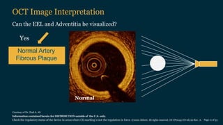 OCT -INTERPRETATION.pptx