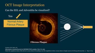 OCT -INTERPRETATION.pptx