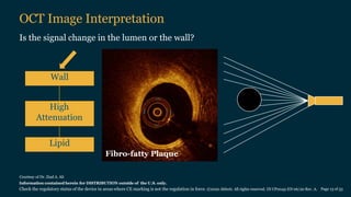 OCT -INTERPRETATION.pptx