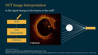 OCT -INTERPRETATION.pptx
