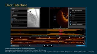 OCT -INTERPRETATION.pptx