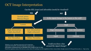 OCT -INTERPRETATION.pptx
