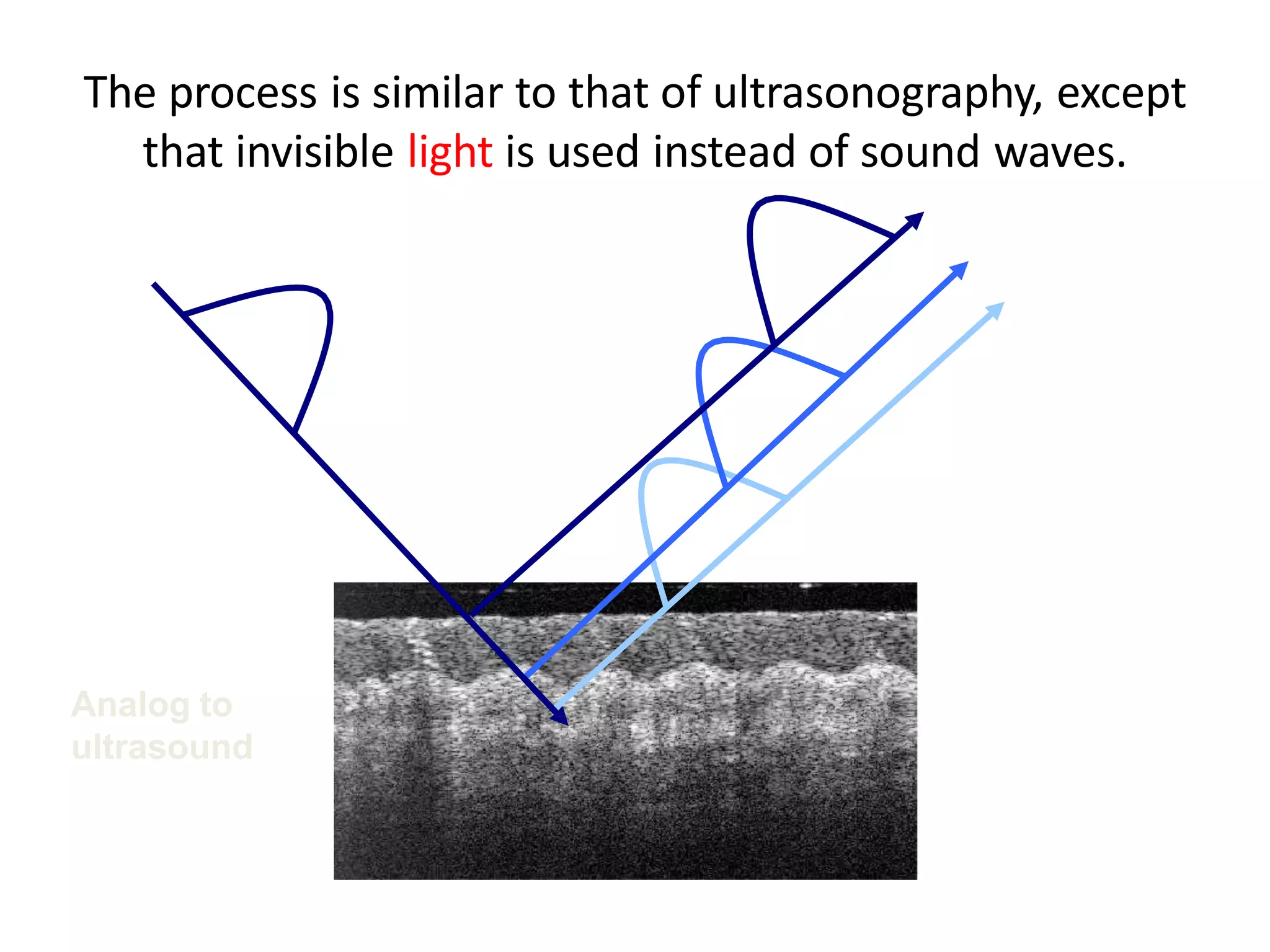 Optical coherence tomography(OCT) --macula | PPTX