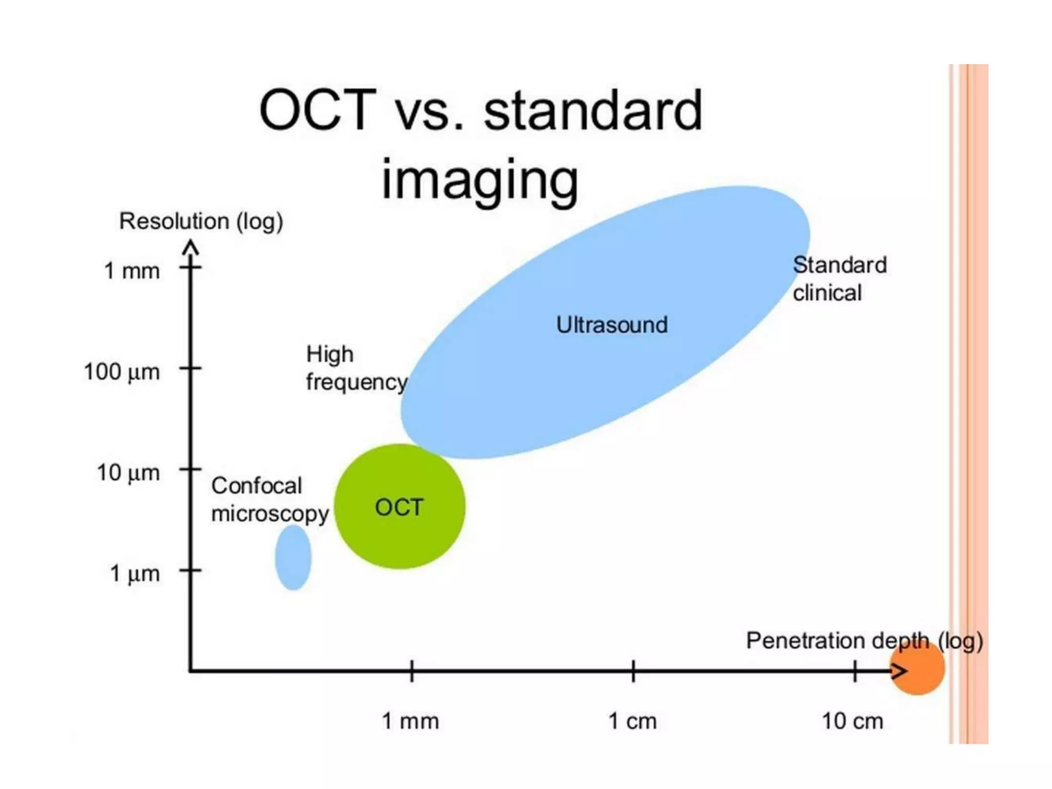Optical coherence tomography(OCT) --macula | PPTX