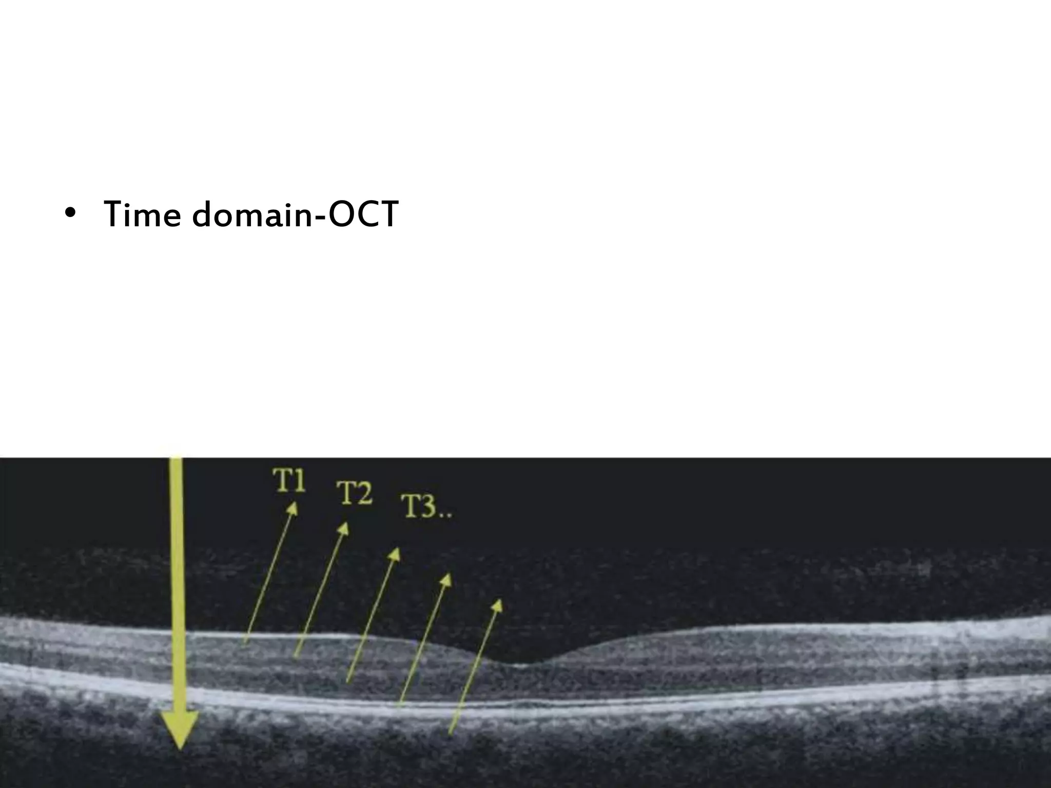 Optical coherence tomography(OCT) --macula | PPTX