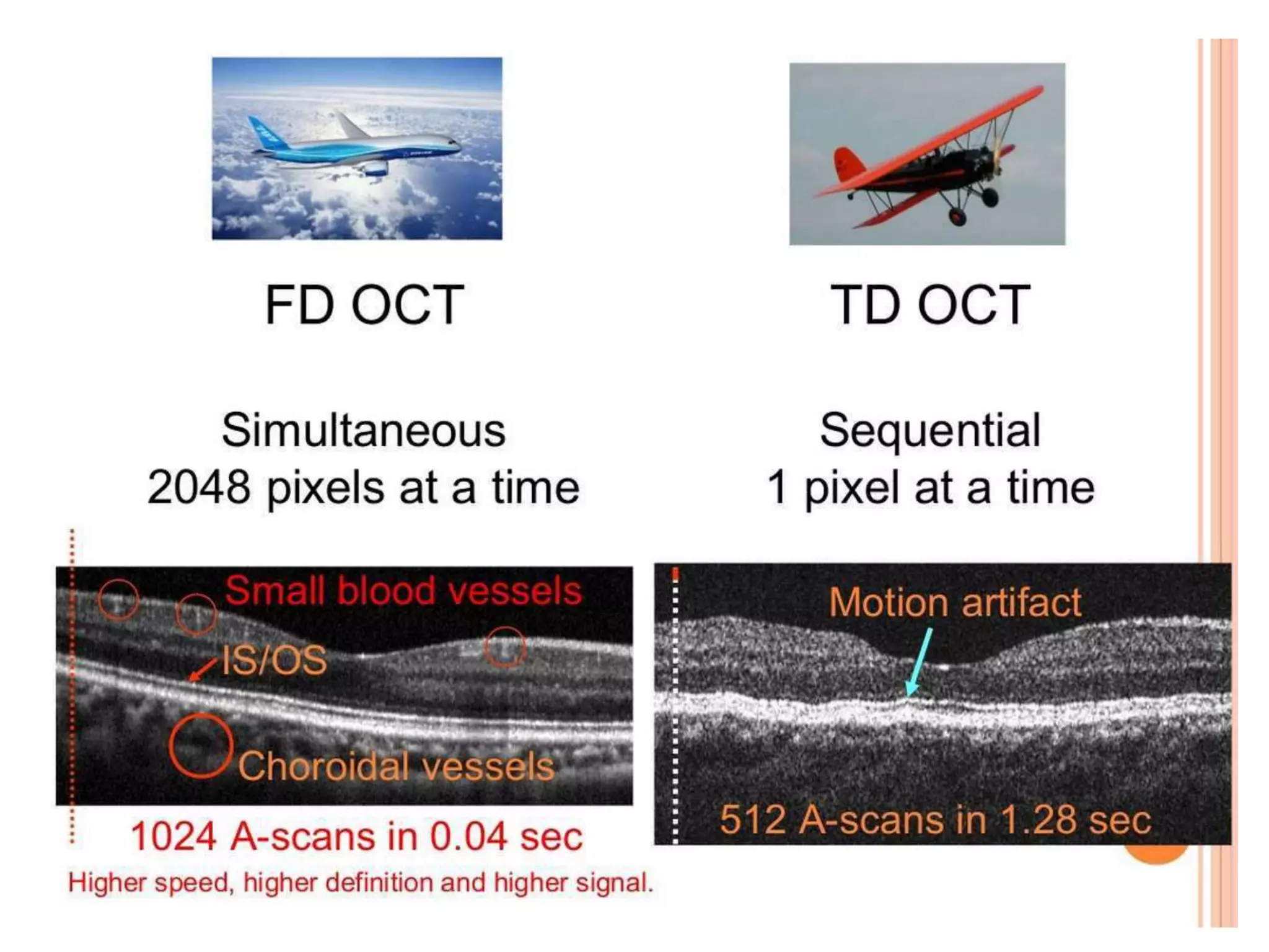 Optical coherence tomography(OCT) --macula | PPTX