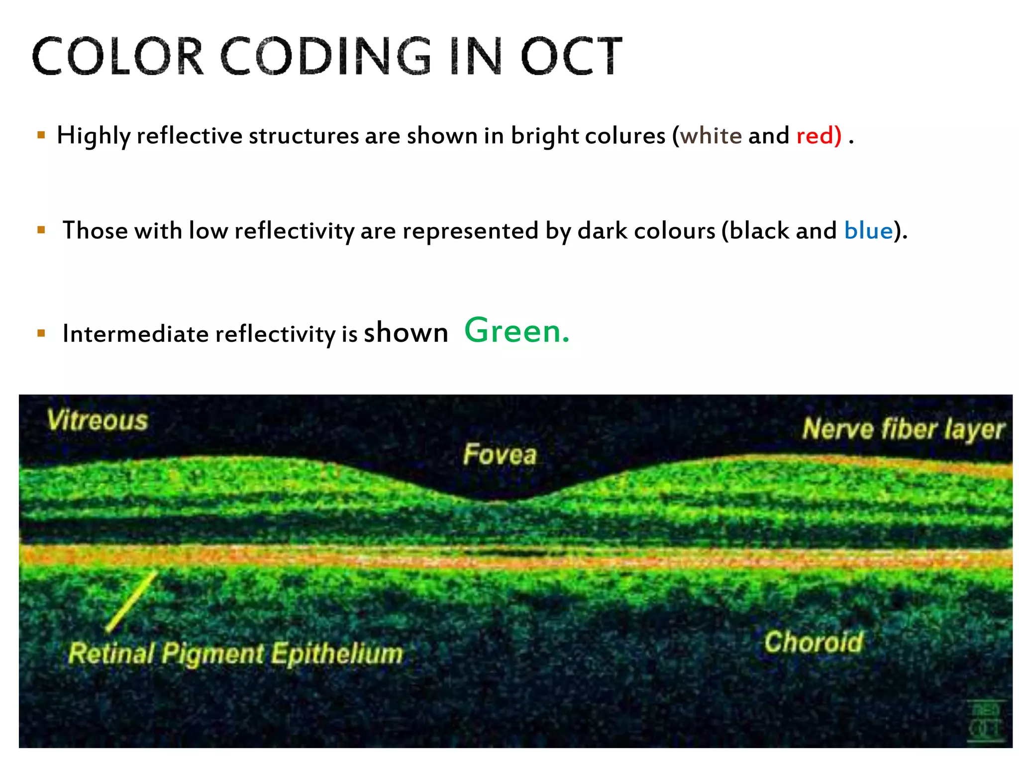 Optical coherence tomography(OCT) --macula | PPTX