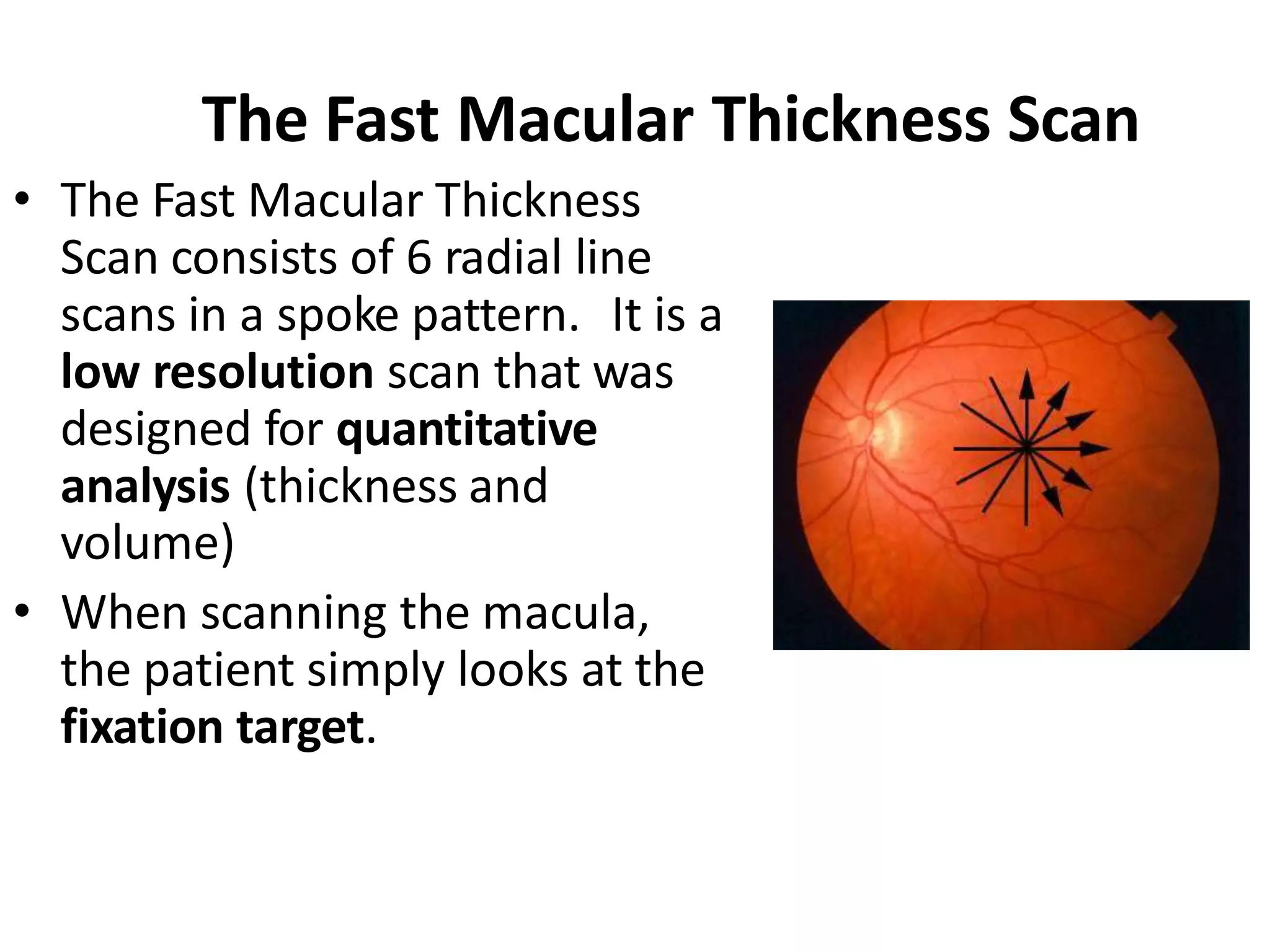 Optical coherence tomography(OCT) --macula | PPTX