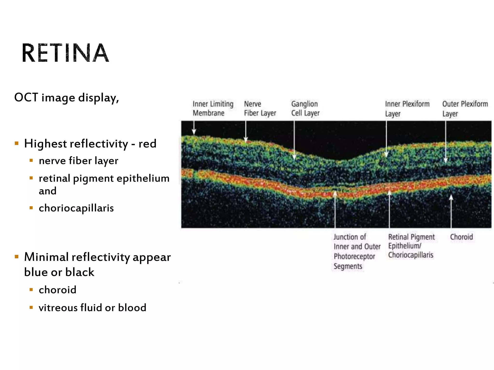 Optical coherence tomography(OCT) --macula | PPTX | Eye and Vision ...