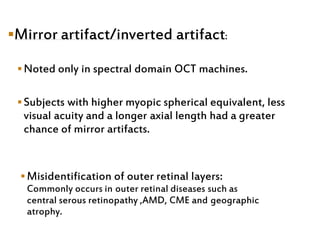 Optical coherence tomography(OCT) --macula | PPTX