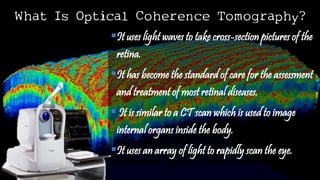 OPTICAL COHERENCE TOMOGRAPHY SCAN | PPT