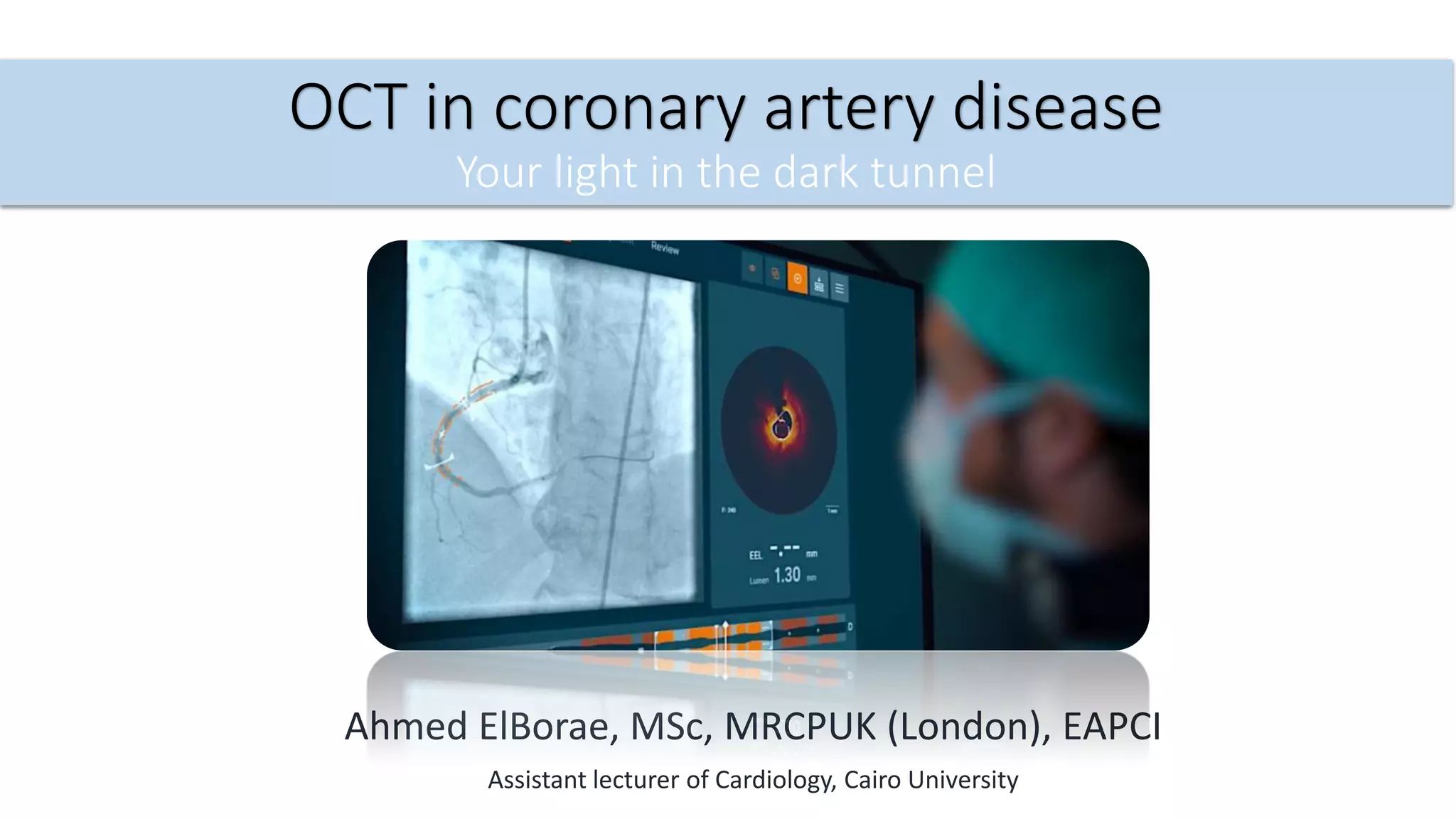 OCT in coronary PCI | PDF