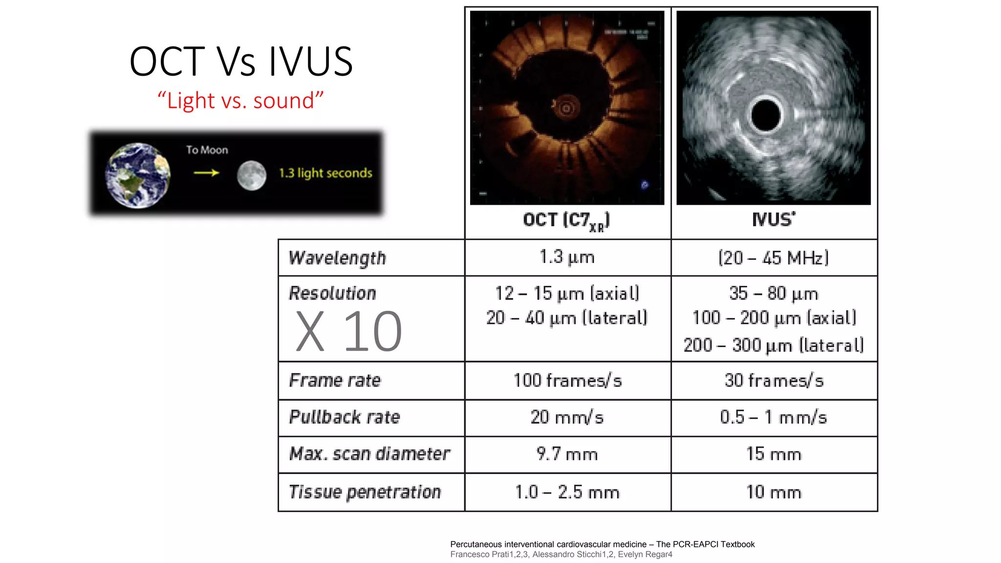 OCT in coronary PCI | PDF