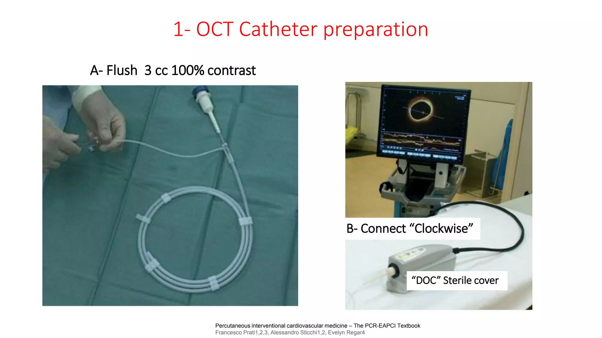 OCT in coronary PCI | PDF