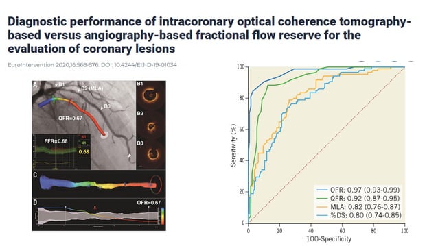 OCT in coronary PCI | PDF
