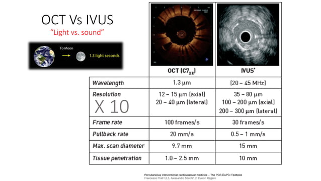 OCT in coronary PCI | PDF