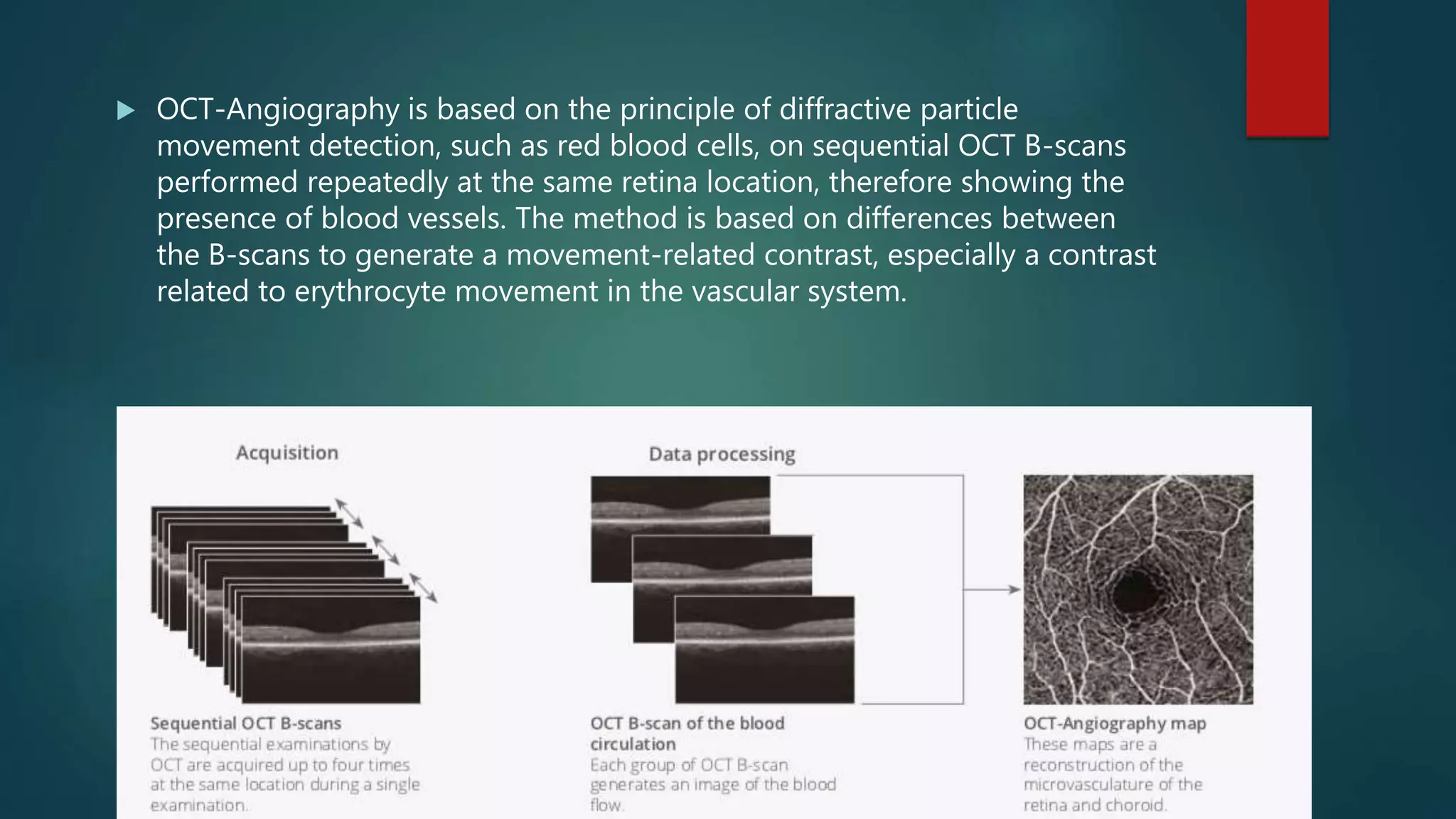 OCT Angiography | PPTX