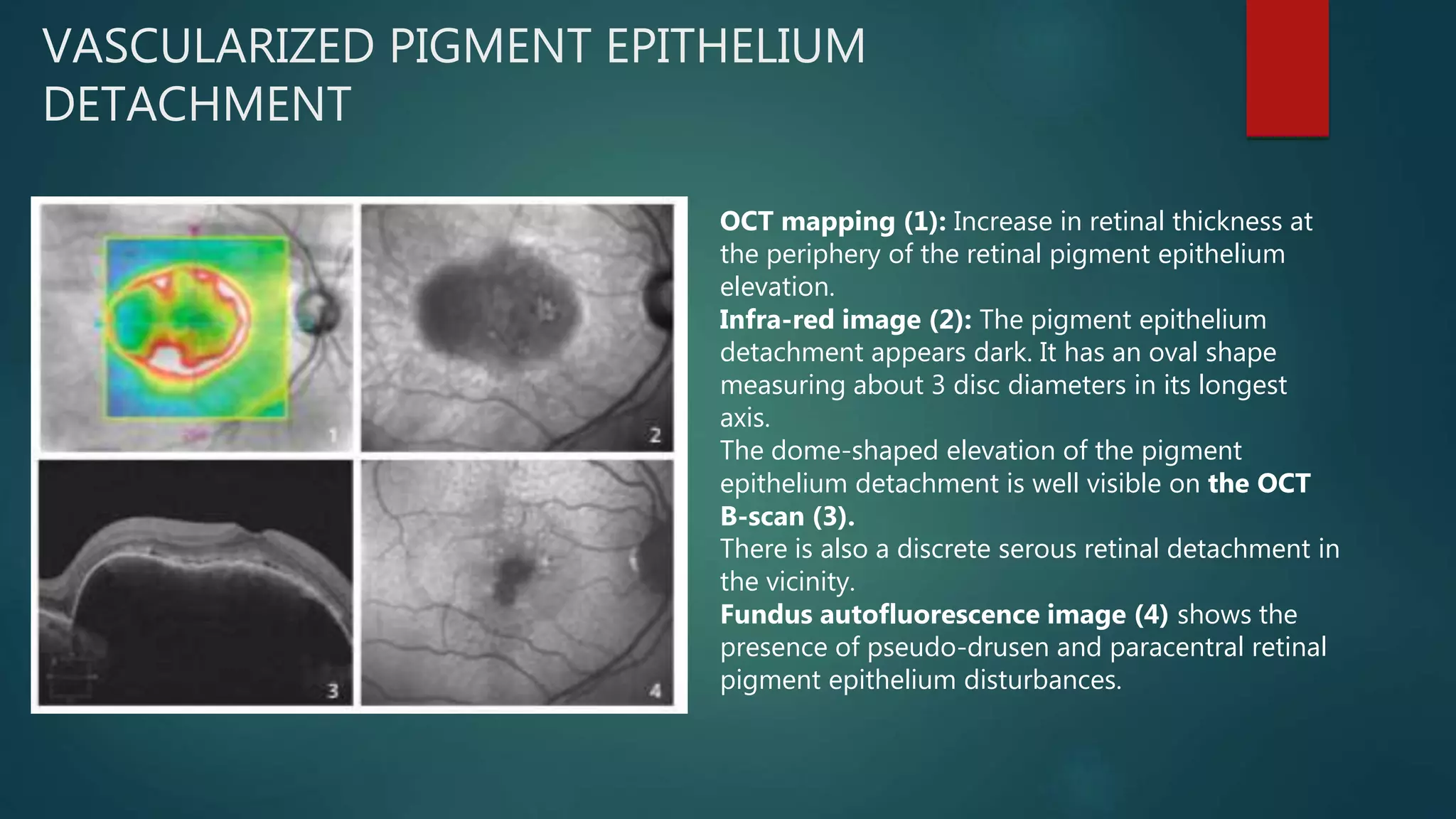 OCT Angiography | PPTX