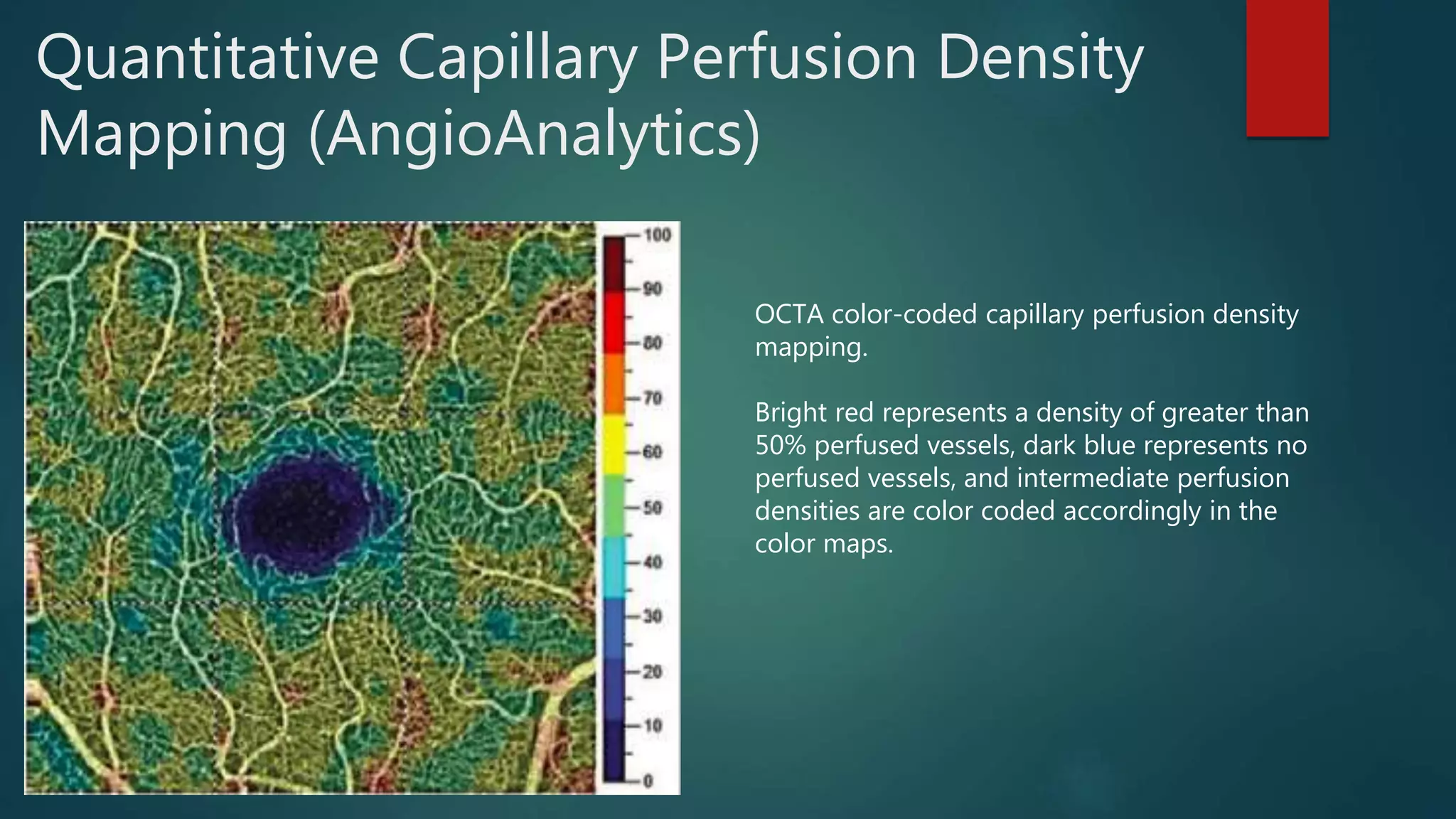OCT Angiography | PPTX