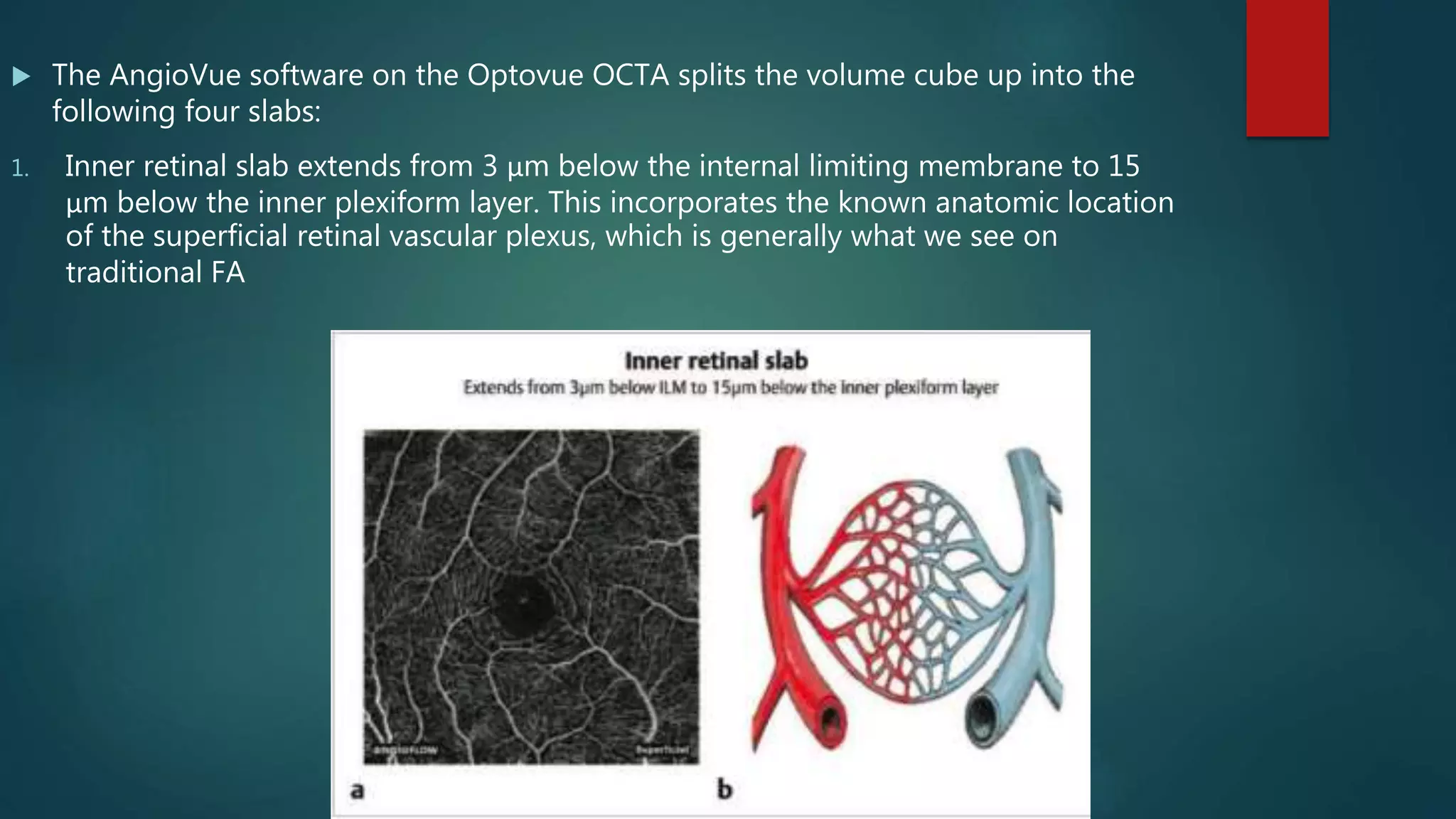 OCT Angiography | PPTX