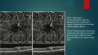 OCT Angiography | PPTX