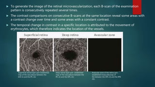 OCT Angiography | PPTX