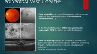 OCT Angiography | PPTX