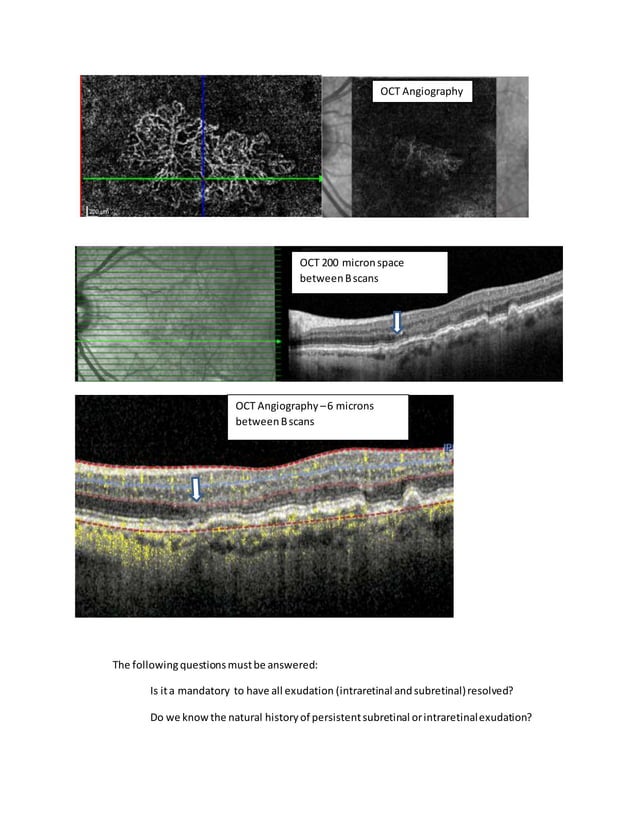 OCT ANGIOGRAPHY | DOCX