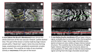 OPTICAL COHERENCE TOMOGRAPHY ANGIOGRAPHY | PPTX