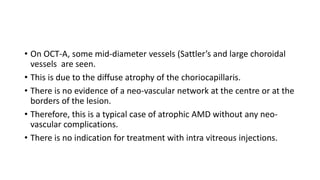 OPTICAL COHERENCE TOMOGRAPHY ANGIOGRAPHY | PPTX