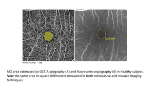 OPTICAL COHERENCE TOMOGRAPHY ANGIOGRAPHY | PPTX