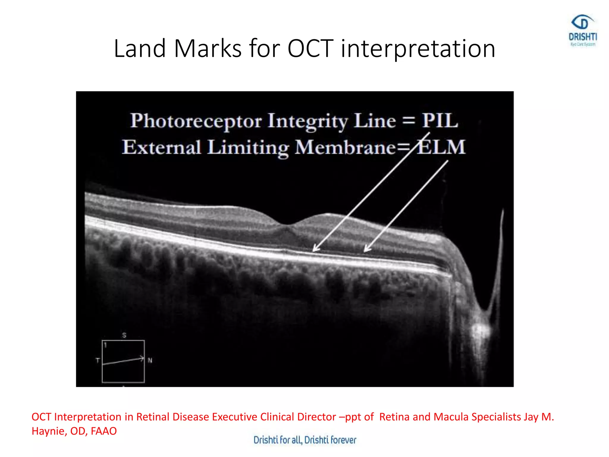 ABC of Oct and octa | PPTX