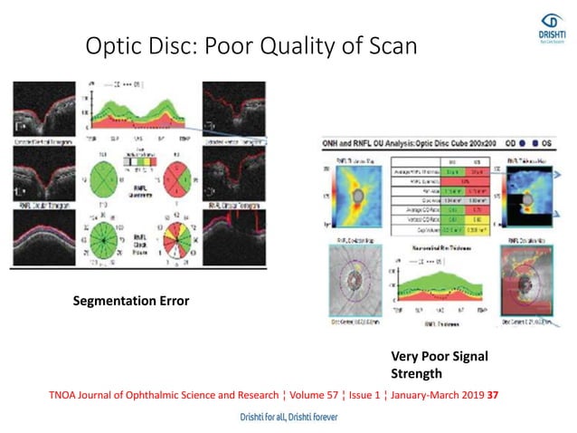 ABC of Oct and octa | PPT