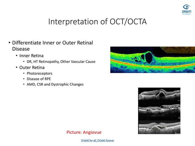 ABC of Oct and octa | PPT