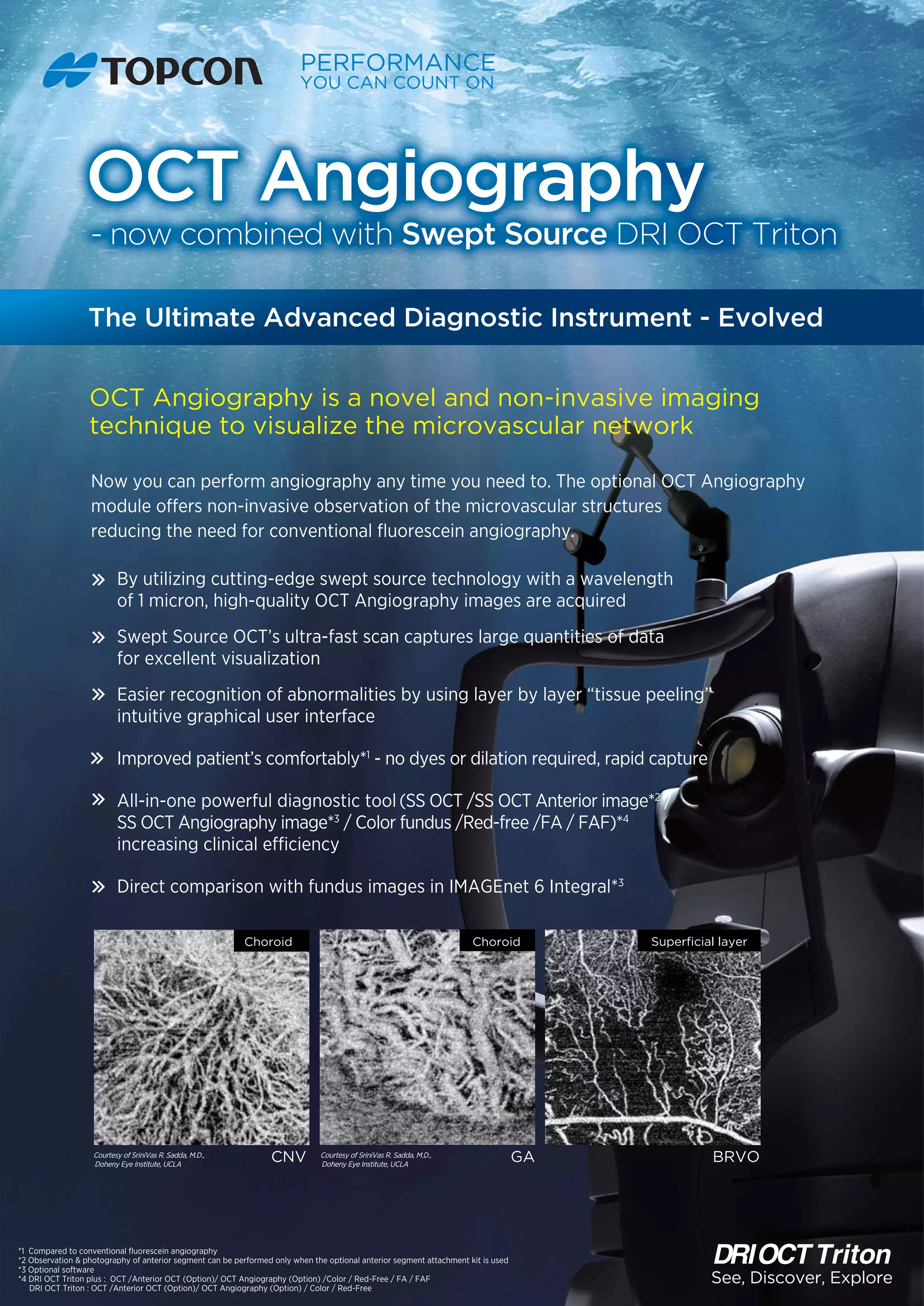 Oct angiography | PDF