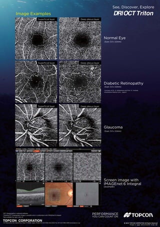 Oct angiography | PDF