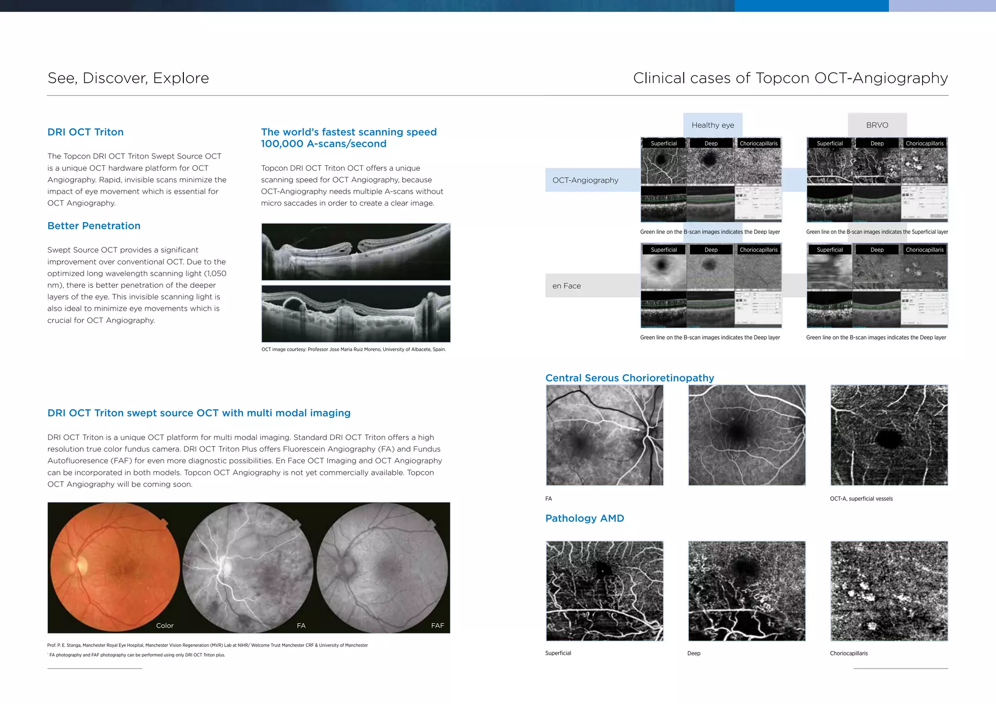 Oct angiography topcon leaflet may 2015 | PDF