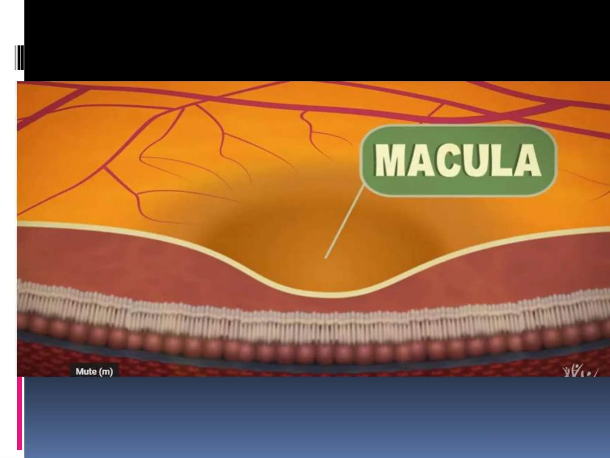 OCT ango in ARMD and telangictasia.pptx