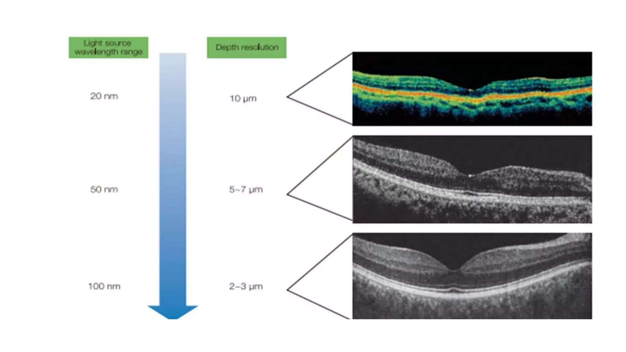 OCT MACULA INTERPRETATION. | PPTX