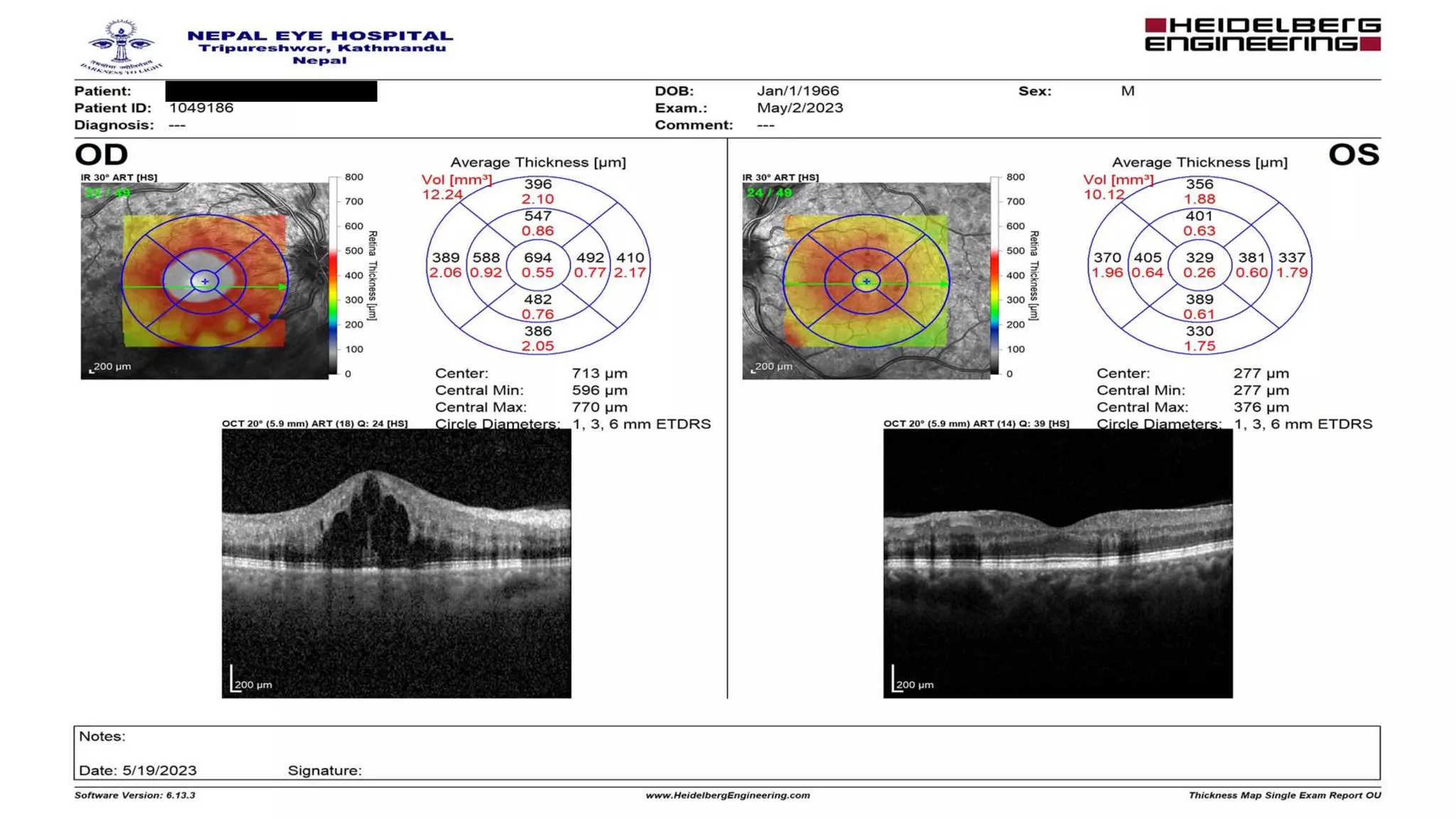OCT MACULA INTERPRETATION. | PPTX