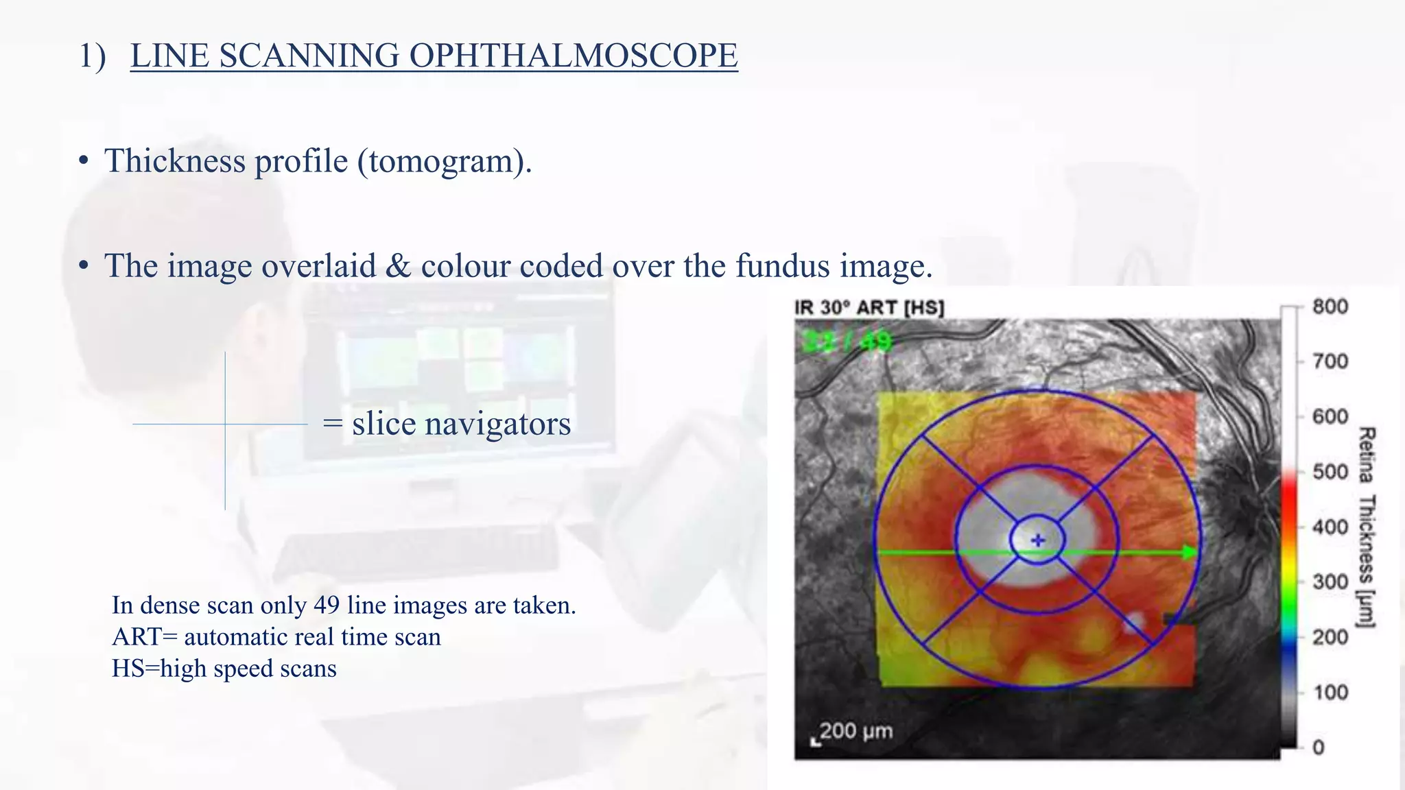 OCT MACULA INTERPRETATION. | PPTX