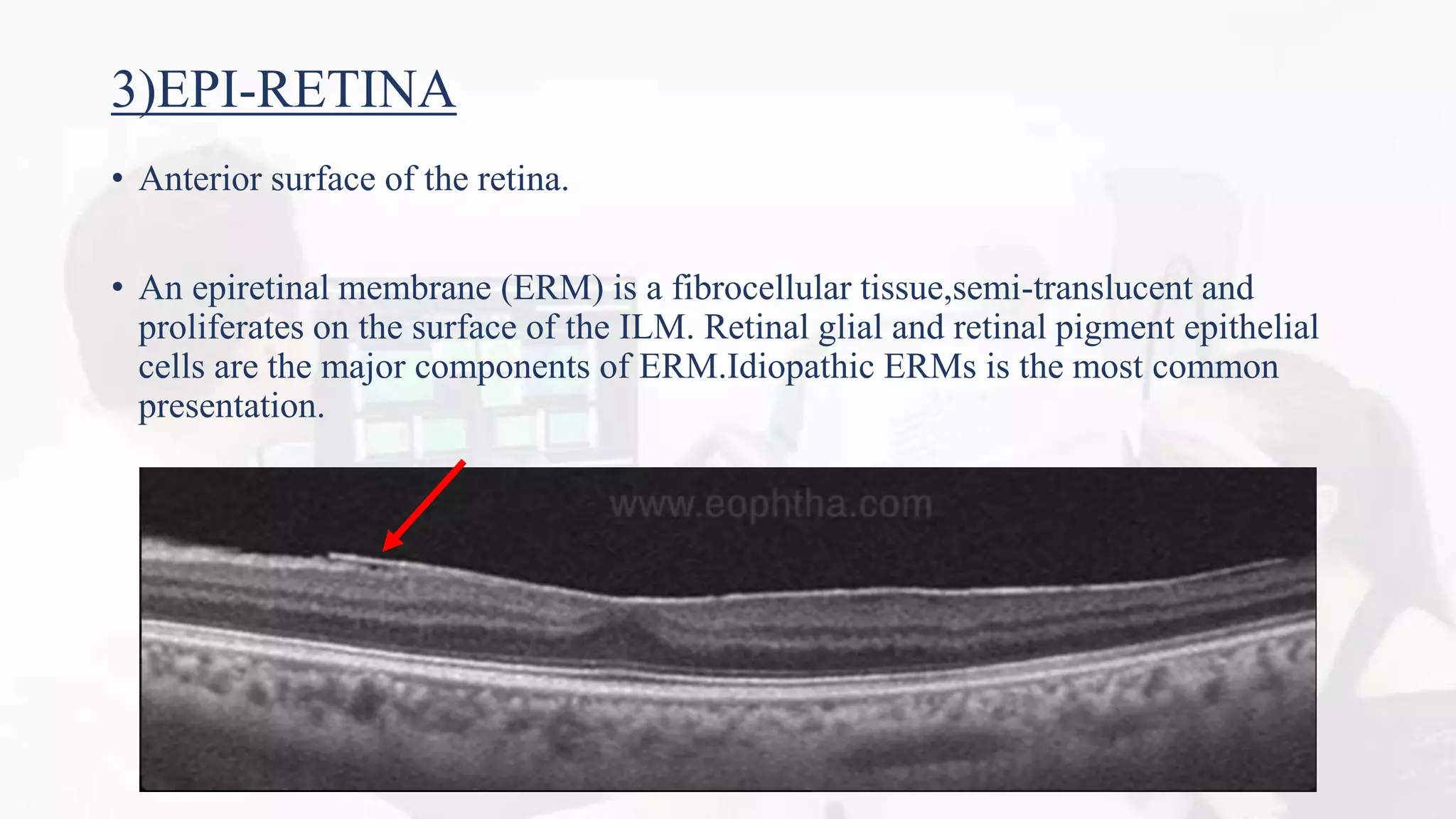 OCT MACULA INTERPRETATION. | PPTX