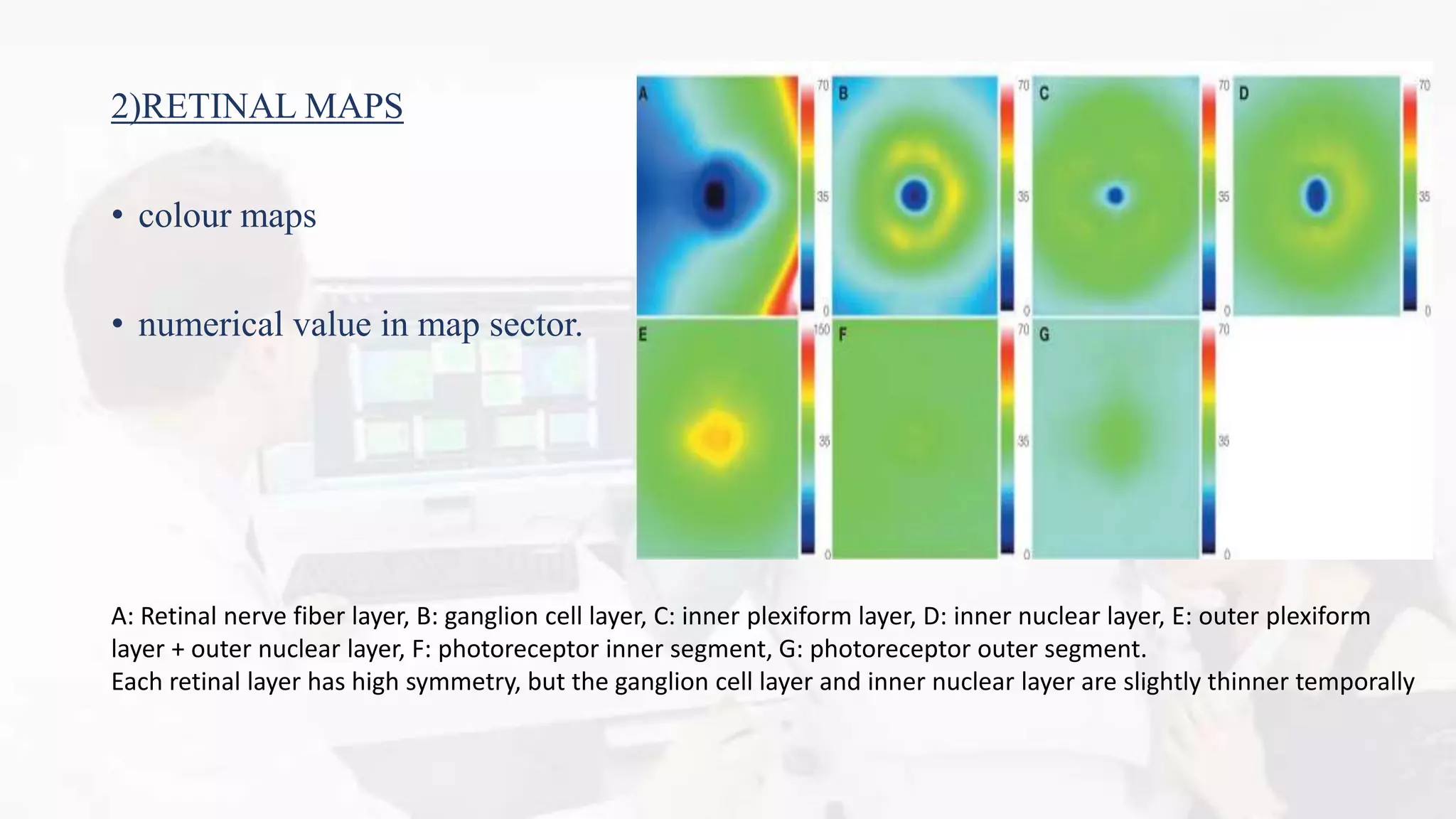 OCT MACULA INTERPRETATION. | PPTX