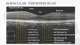 OCT MACULA INTERPRETATION. | PPTX